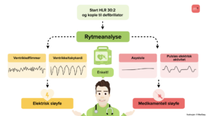Nye retningslinjer for hjerte-lunge-redning